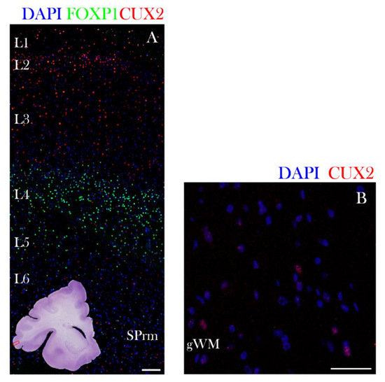 Adult Upper Cortical Layer Specific Transcription Factor CUX2 Is ...