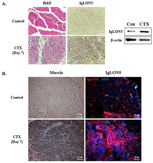 IgLON5 Regulates the Adhesion and Differentiation of Myoblasts