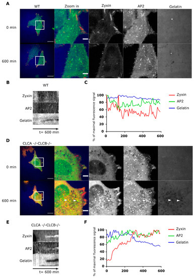 Role of Clathrin Light Chains in Regulating Invadopodia Formation