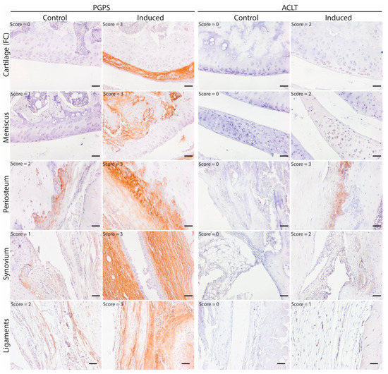 Association between Oncostatin M Expression and Inflammatory Phenotype ...