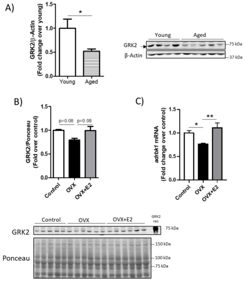 Cardiac GRK2 Protein Levels Show Sexual Dimorphism during Aging and Are ...