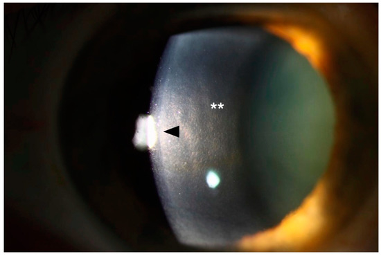 Cell–Matrix Interactions in the Eye: From Cornea to Choroid