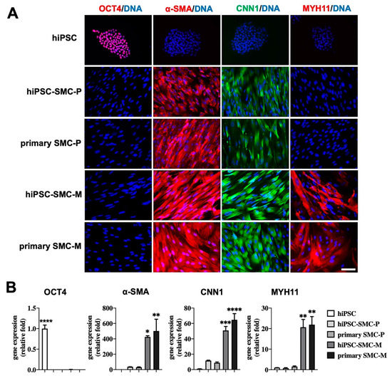 Human-Induced Pluripotent Stem-Cell-Derived Smooth Muscle Cells Increase Angiogenesis to Treat ...