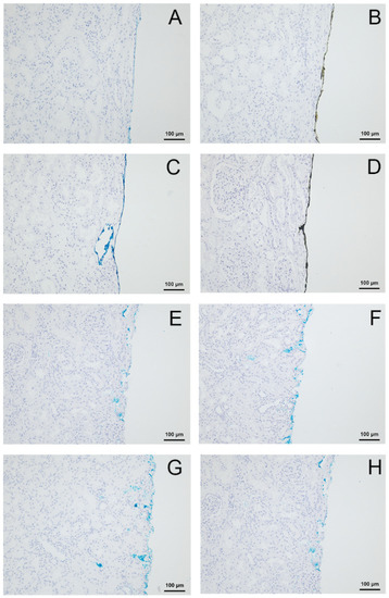 Alteration of Tissue Marking Dyes Depends on Used Chromogen during ...