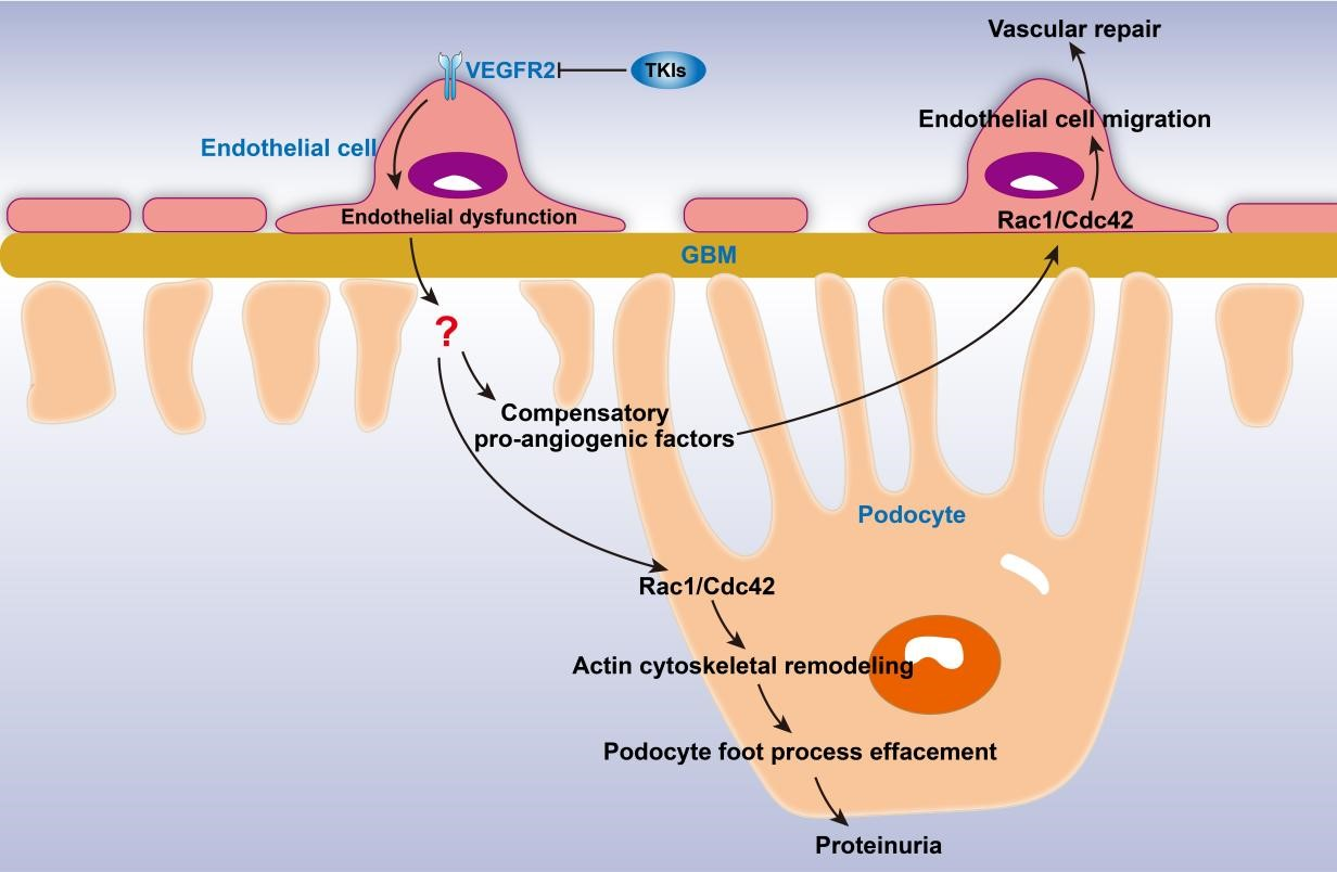Cells | Free Full-Text | Abnormal Crosstalk between Endothelial Cells ...