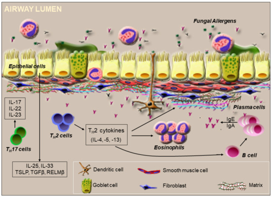 Initiation and Pathogenesis of Severe Asthma with Fungal Sensitization