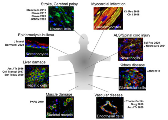 Non-Tumorigenic Pluripotent Reparative Muse Cells Provide a New ...