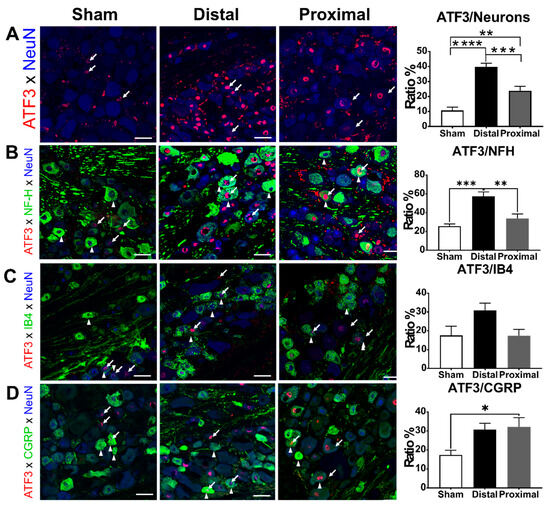 Cells Free Full Text Atf3 Expressing Large Diameter Sensory