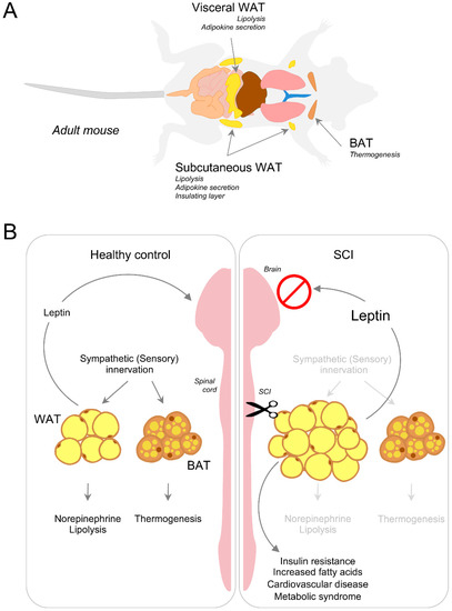 The Role of Lipids, Lipid Metabolism and Ectopic Lipid Accumulation in ...
