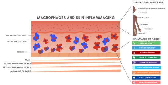 Cells | Free Full-Text | Hallmarks of Aging in Macrophages ...