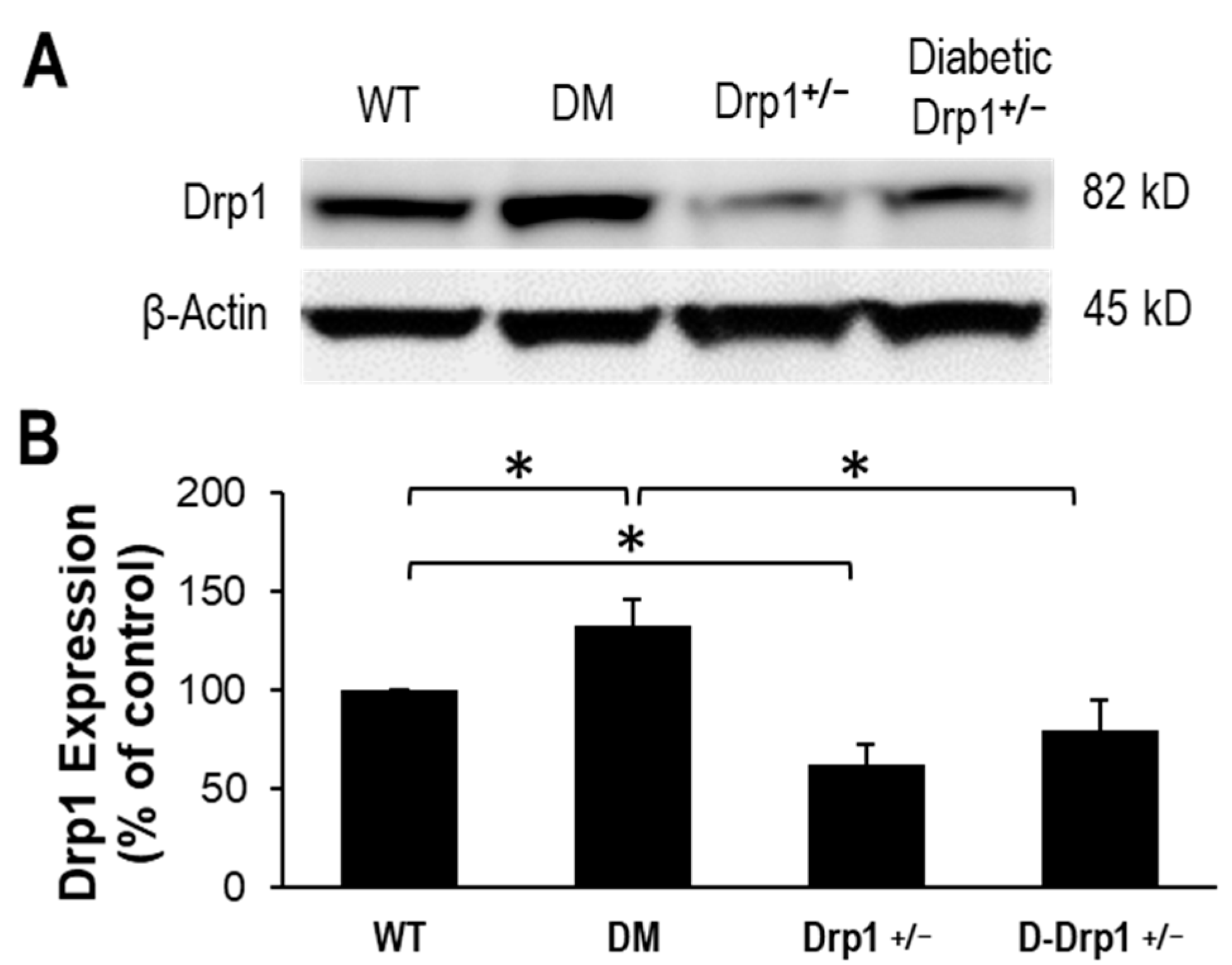 Reduced Levels of Drp1 Protect against Development of Retinal Vascular ...