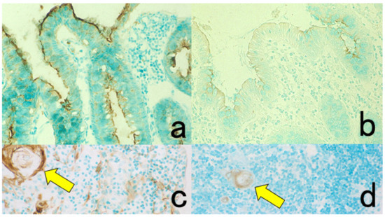 Pitfalls and Caveats in Applying Chromogenic Immunostaining to ...