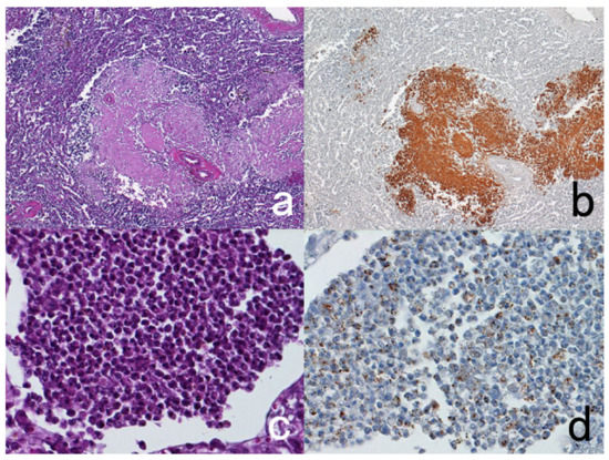 Pitfalls and Caveats in Applying Chromogenic Immunostaining to ...