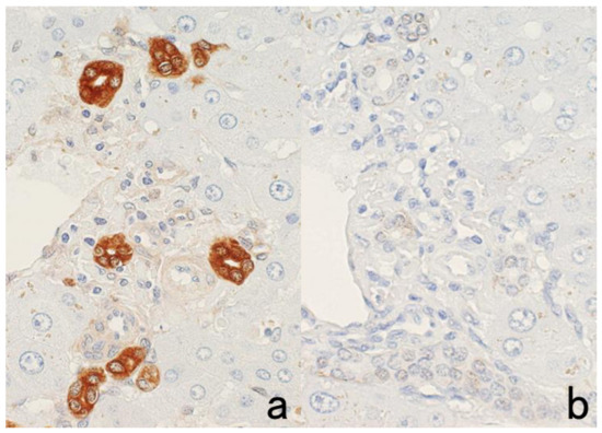 Pitfalls and Caveats in Applying Chromogenic Immunostaining to ...