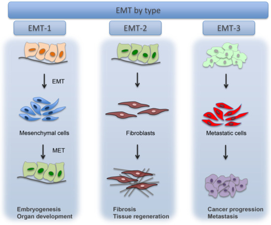 Epithelial-Mesenchymal Transition (EMT): The Type-2 EMT in Wound ...