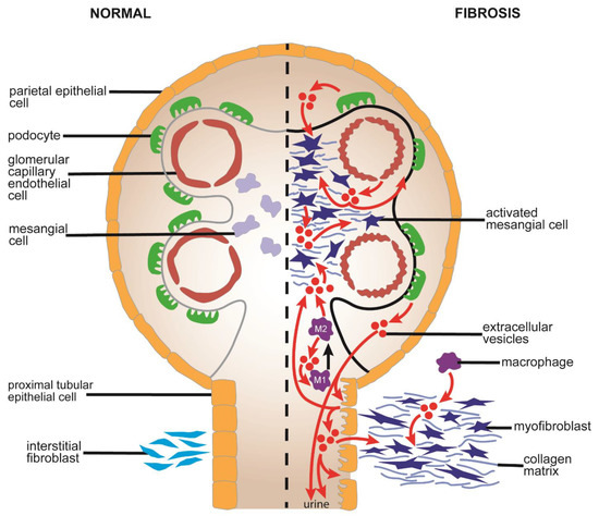 Extracellular Vesicles in Organ Fibrosis: Mechanisms, Therapies, and ...