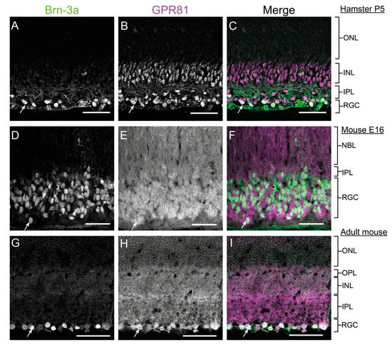 Participation of L-Lactate and Its Receptor HCAR1/GPR81 in Neurovisual ...