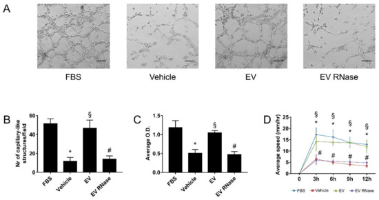 Extracellular Vesicles Derived from Endothelial Progenitor Cells ...