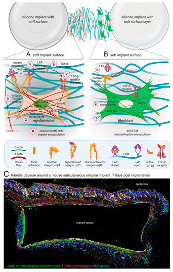 Implant Fibrosis and the Underappreciated Role of Myofibroblasts in the ...