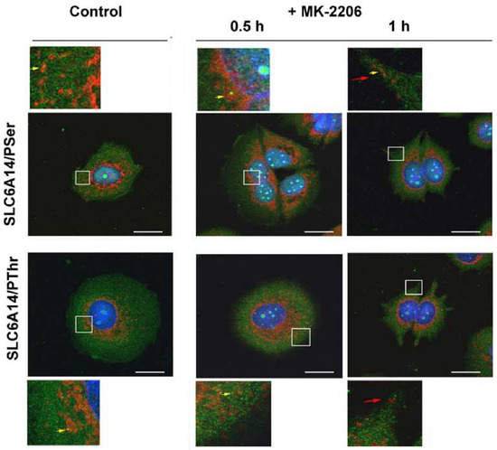 Trafficking to the Cell Surface of Amino Acid Transporter SLC6A14 ...