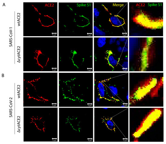 SARS-CoV-2 Cellular Entry Is Independent of the ACE2 Cytoplasmic Domain ...