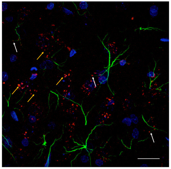 Serotonin Heteroreceptor Complexes and Their Integration of Signals in ...