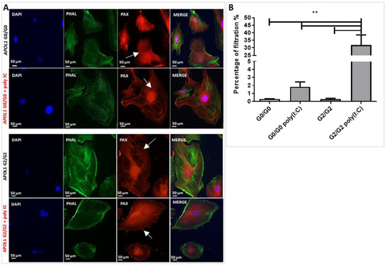 Novel Human Podocyte Cell Model Carrying G2/G2 APOL1 High-Risk Genotype