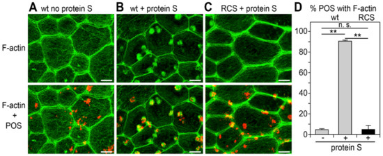 Acute RhoA/Rho Kinase Inhibition Is Sufficient to Restore Phagocytic ...