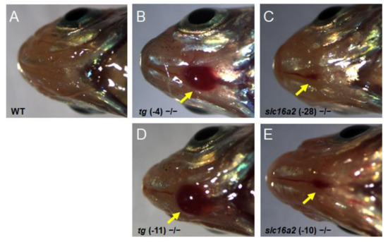 Functions of the Thyroid-Stimulating Hormone on Key Developmental ...
