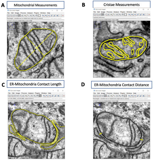 A Universal Approach to Analyzing Transmission Electron Microscopy with ...
