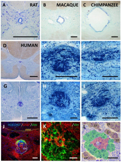 Cells | Free Full-Text | The Structure of the Spinal Cord Ependymal ...