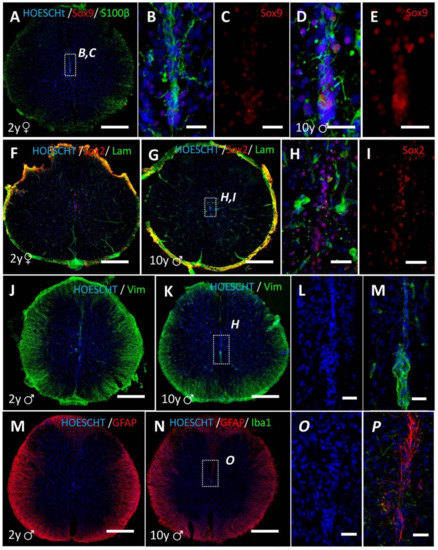 Cells | Free Full-Text | The Structure of the Spinal Cord Ependymal ...