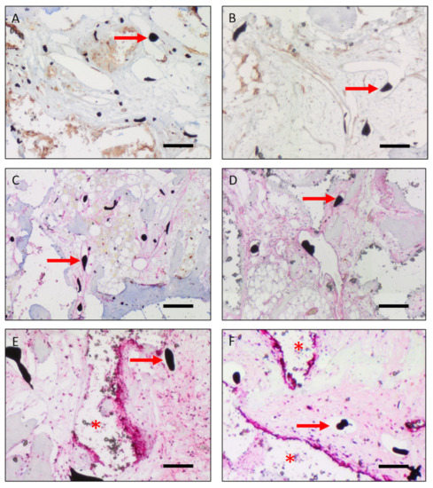 Free Transplantation of a Tissue Engineered Bone Graft into an ...
