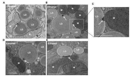 Perspectives on Mitochondria–ER and Mitochondria–Lipid Droplet Contact ...