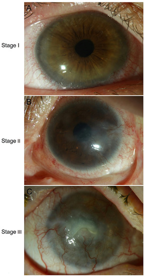 Corneal Epithelial Stem Cells–Physiology, Pathophysiology and ...