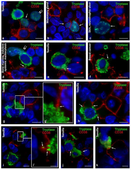 Expression of CD38 in Mast Cells: Cytological and Histotopographic Features