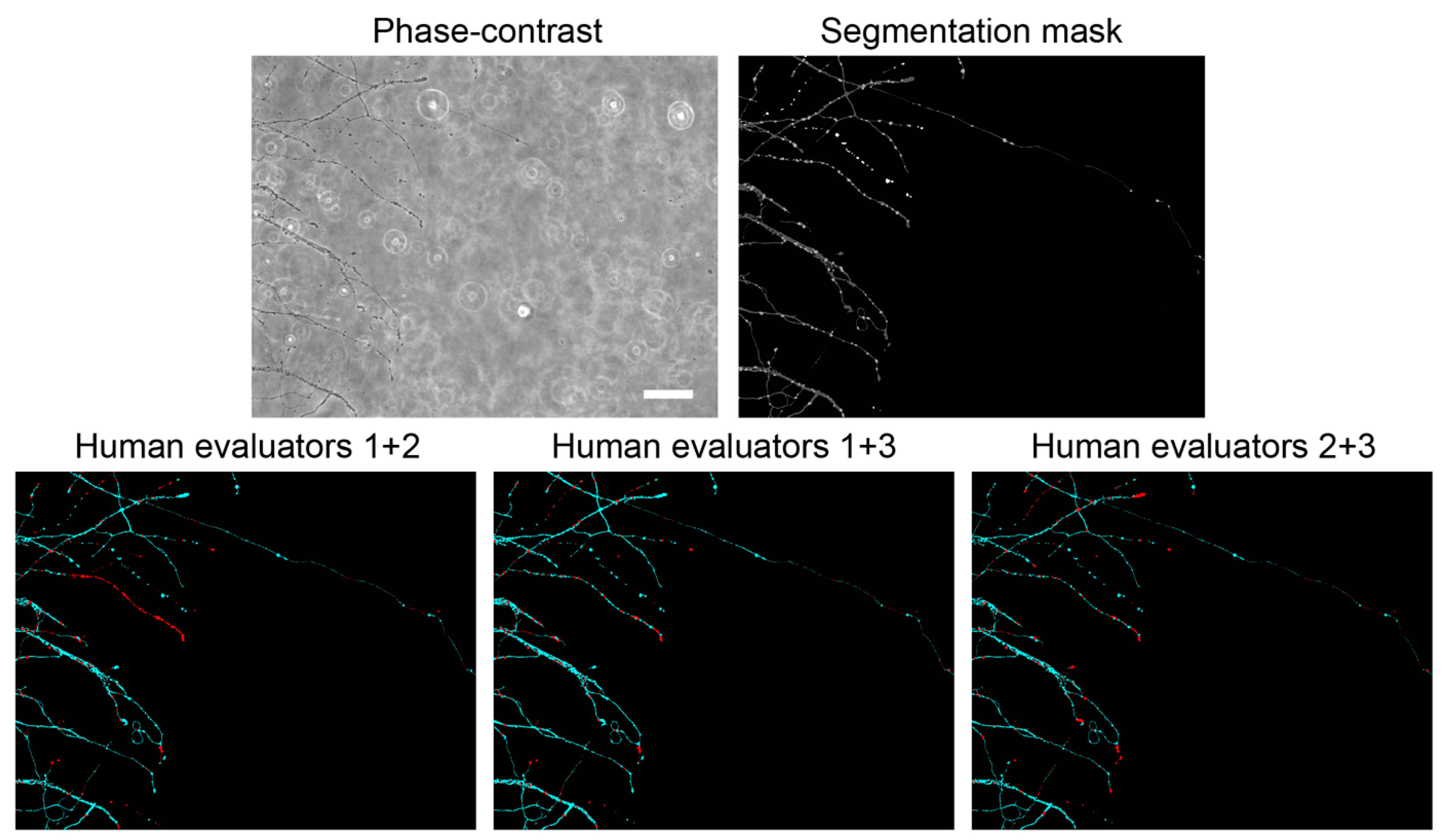 Cells | Free Full-Text | Deep Learning to Decipher the Progression and ...