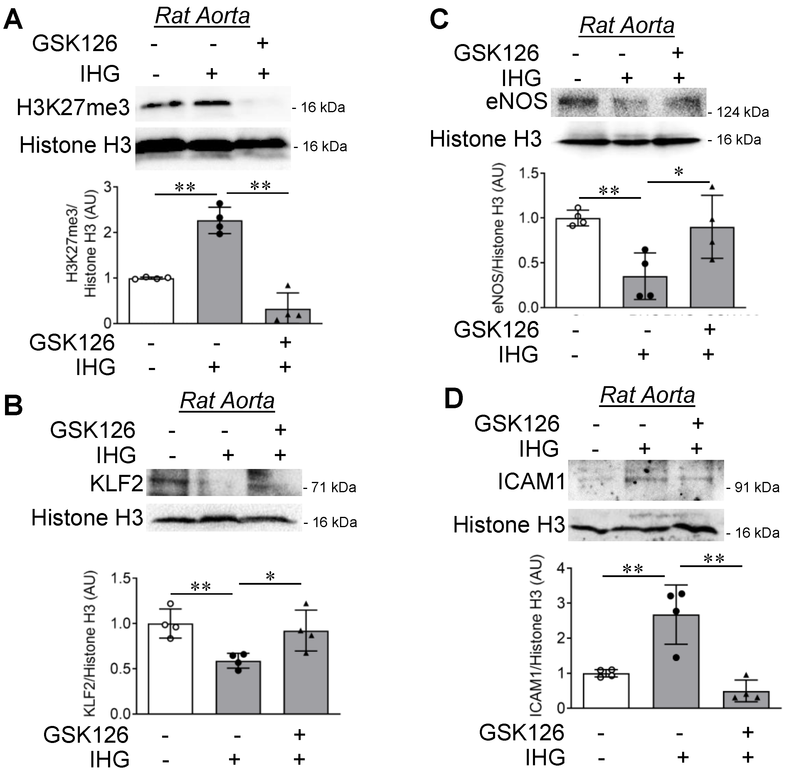 Intermittent High Glucose Elevates Nuclear Localization of EZH2 to ...