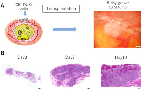 The CAM Model for CIC-DUX4 Sarcoma and Its Potential Use for Precision ...