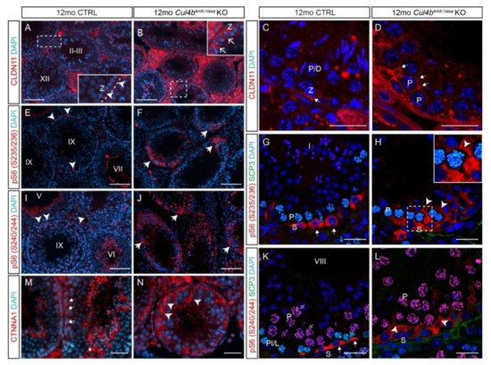 Cullin4 E3 Ubiquitin Ligases Regulate Male Gonocyte Migration ...