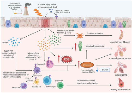 Cells | Free Full-Text | The Role of Epithelial Damage in the Pulmonary ...