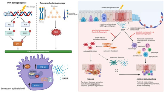 The Role of Epithelial Damage in the Pulmonary Immune Response