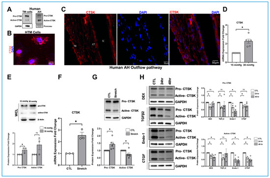 Cells | Free Full-Text | Cathepsin K Regulates Intraocular Pressure by ...