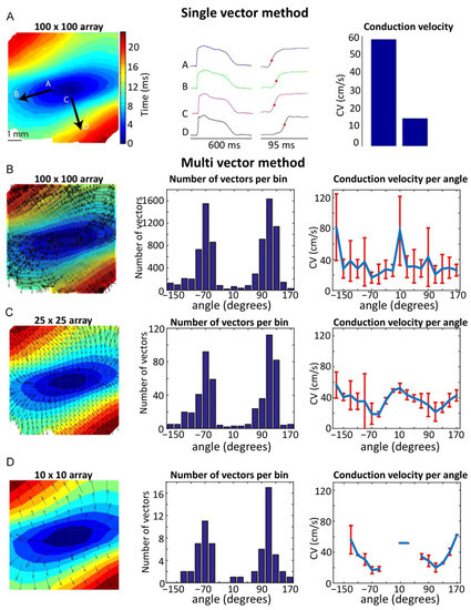 Cardiac Conduction Velocity, Remodeling and Arrhythmogenesis