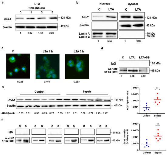 ACLY Nuclear Translocation in Human Macrophages Drives Proinflammatory ...