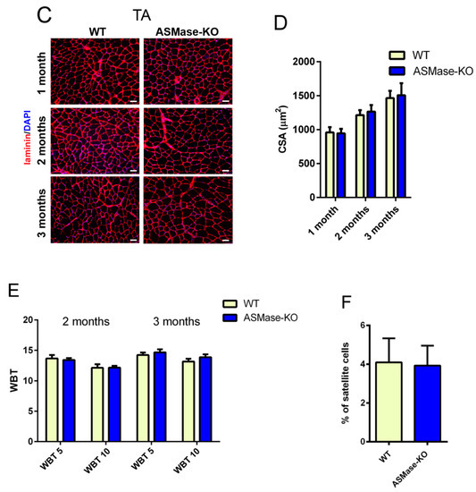 Acid Sphingomyelinase Controls Early Phases of Skeletal Muscle ...