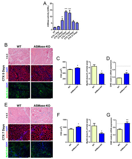Acid Sphingomyelinase Controls Early Phases of Skeletal Muscle ...