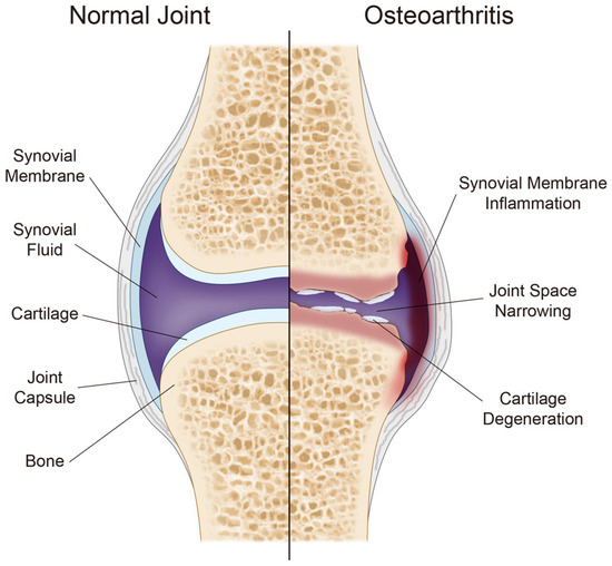 Cells | Free Full-Text | Application of Induced Pluripotent Stem Cells ...