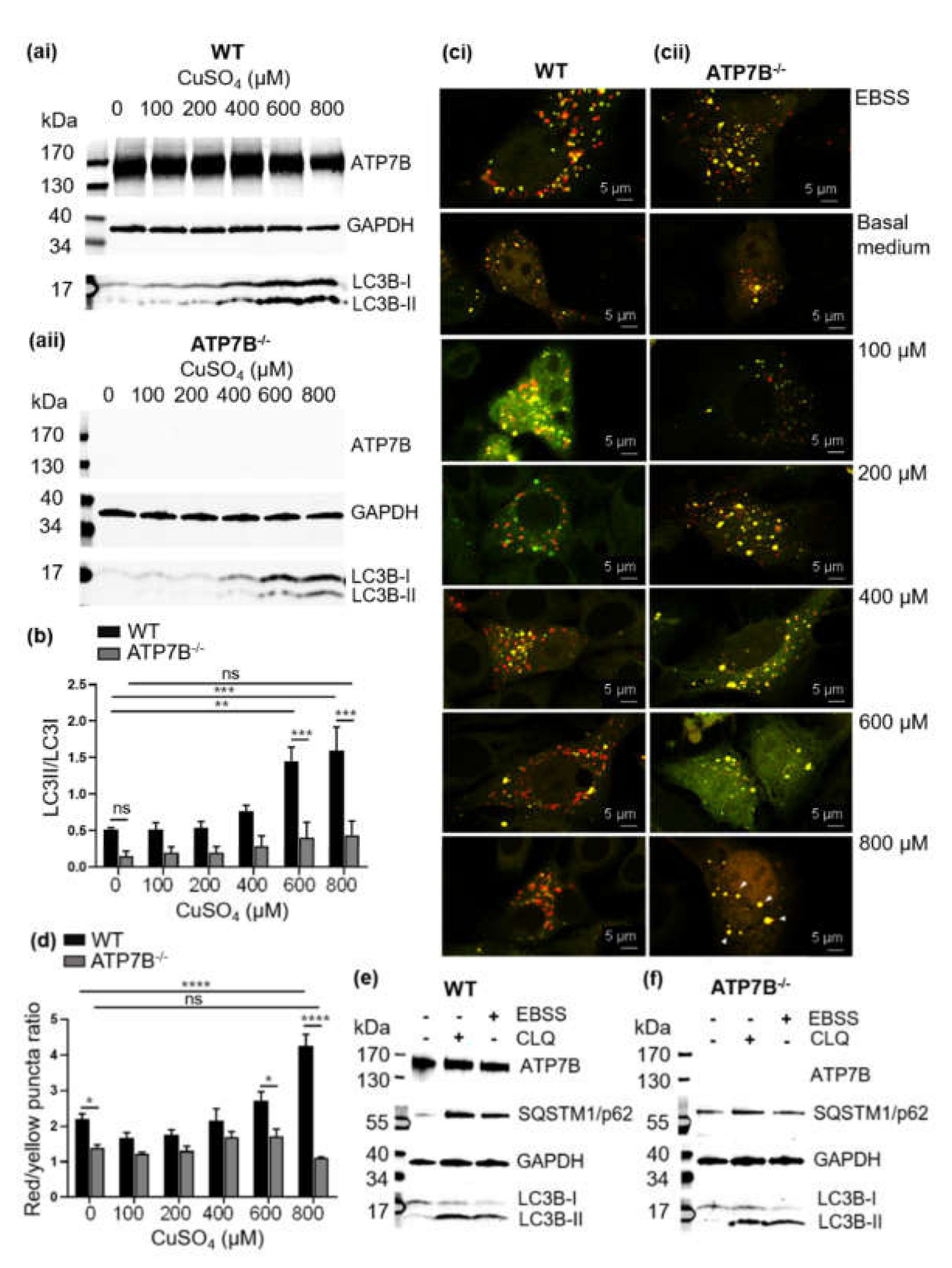 Direct Interaction of ATP7B and LC3B Proteins Suggests a Cooperative ...