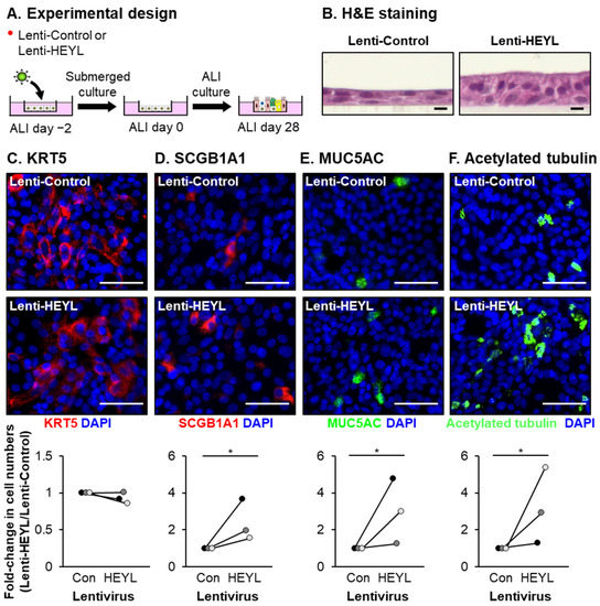 The NOTCH3 Downstream Target HEYL Is Required for Efficient Human ...